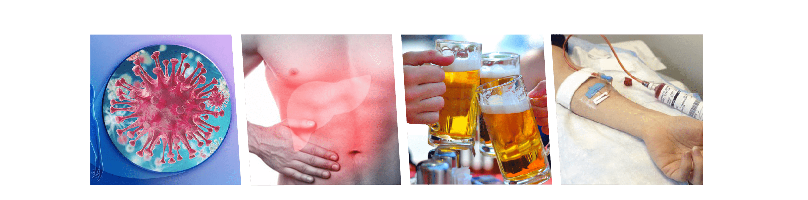 Heposal - Giải pháp chuyên biệt ngừa biến chứng xơ gan, ung thư gan